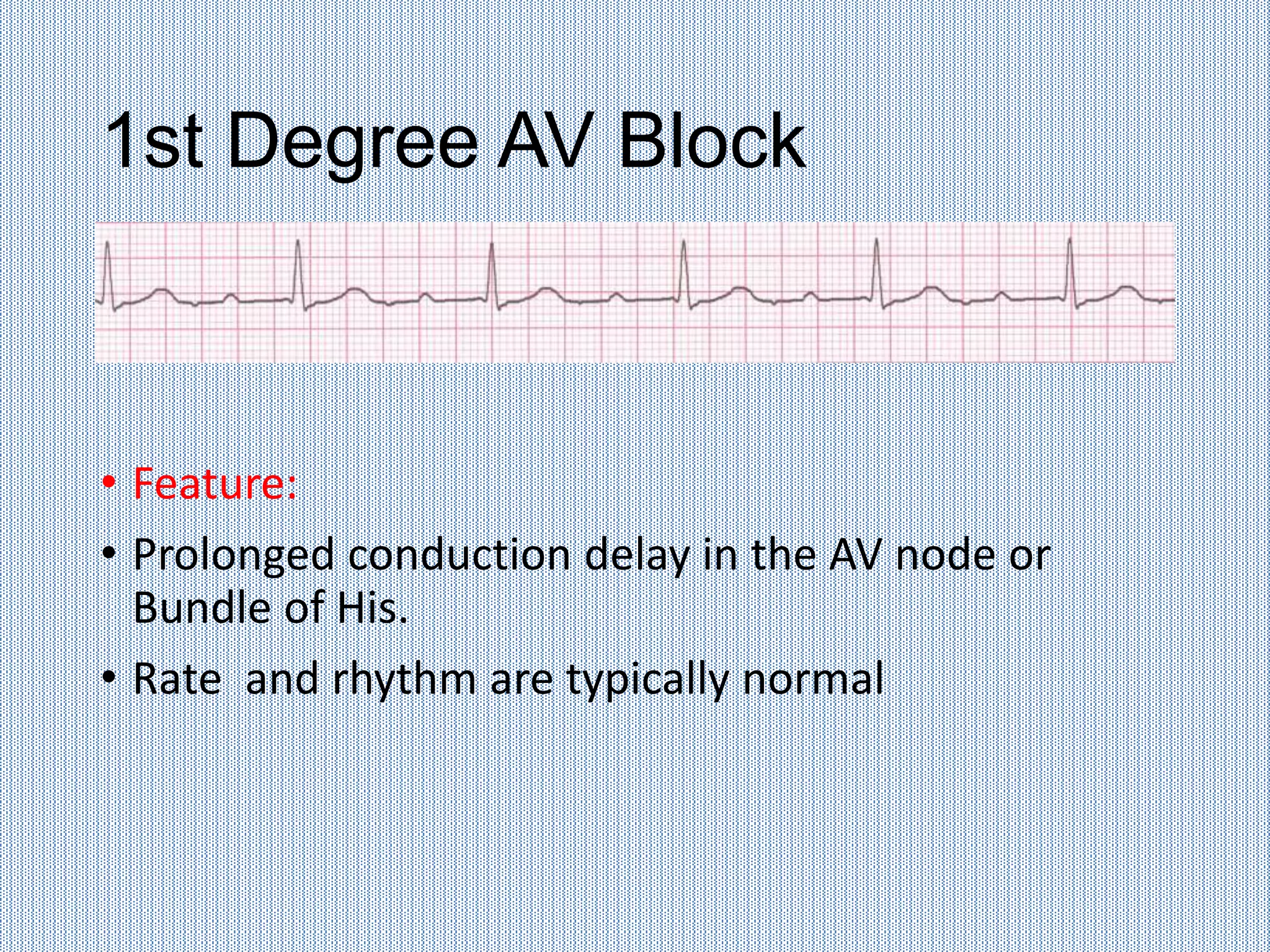 Interpretation of ECG lab session.ppt