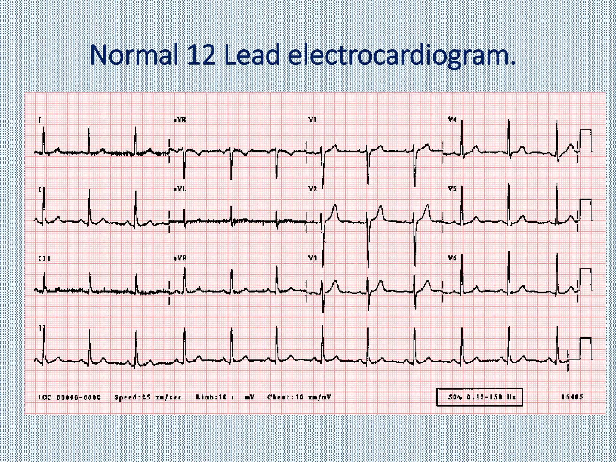 Interpretation of ECG lab session.ppt