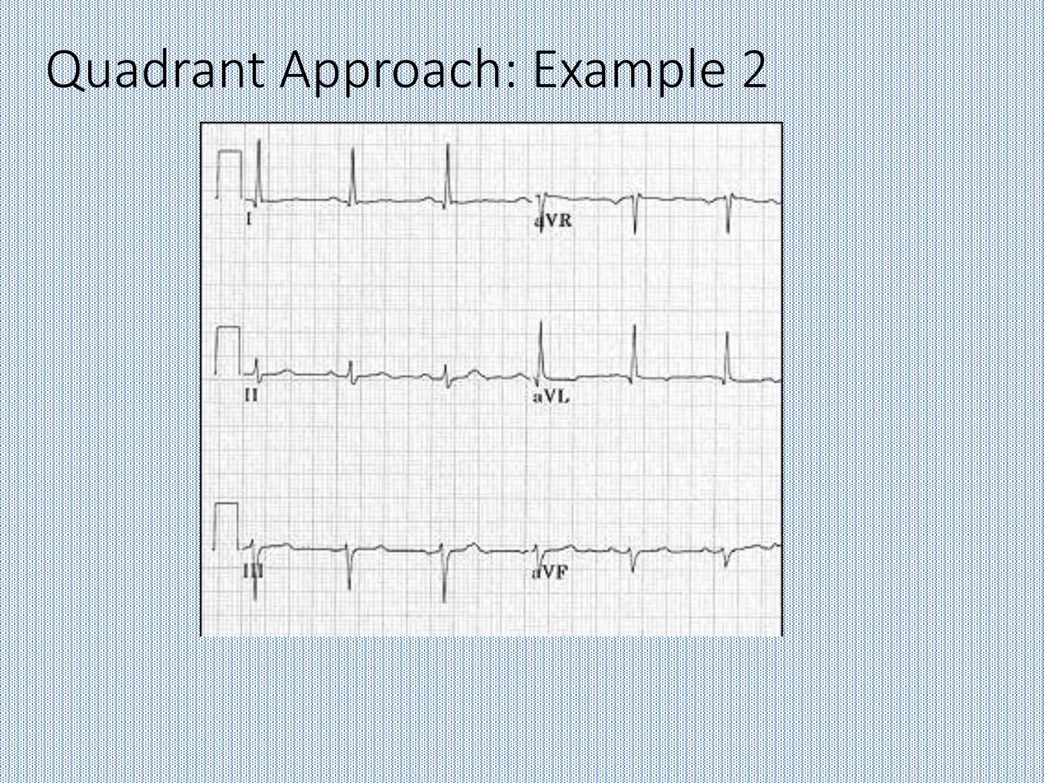Interpretation of ECG lab session.ppt