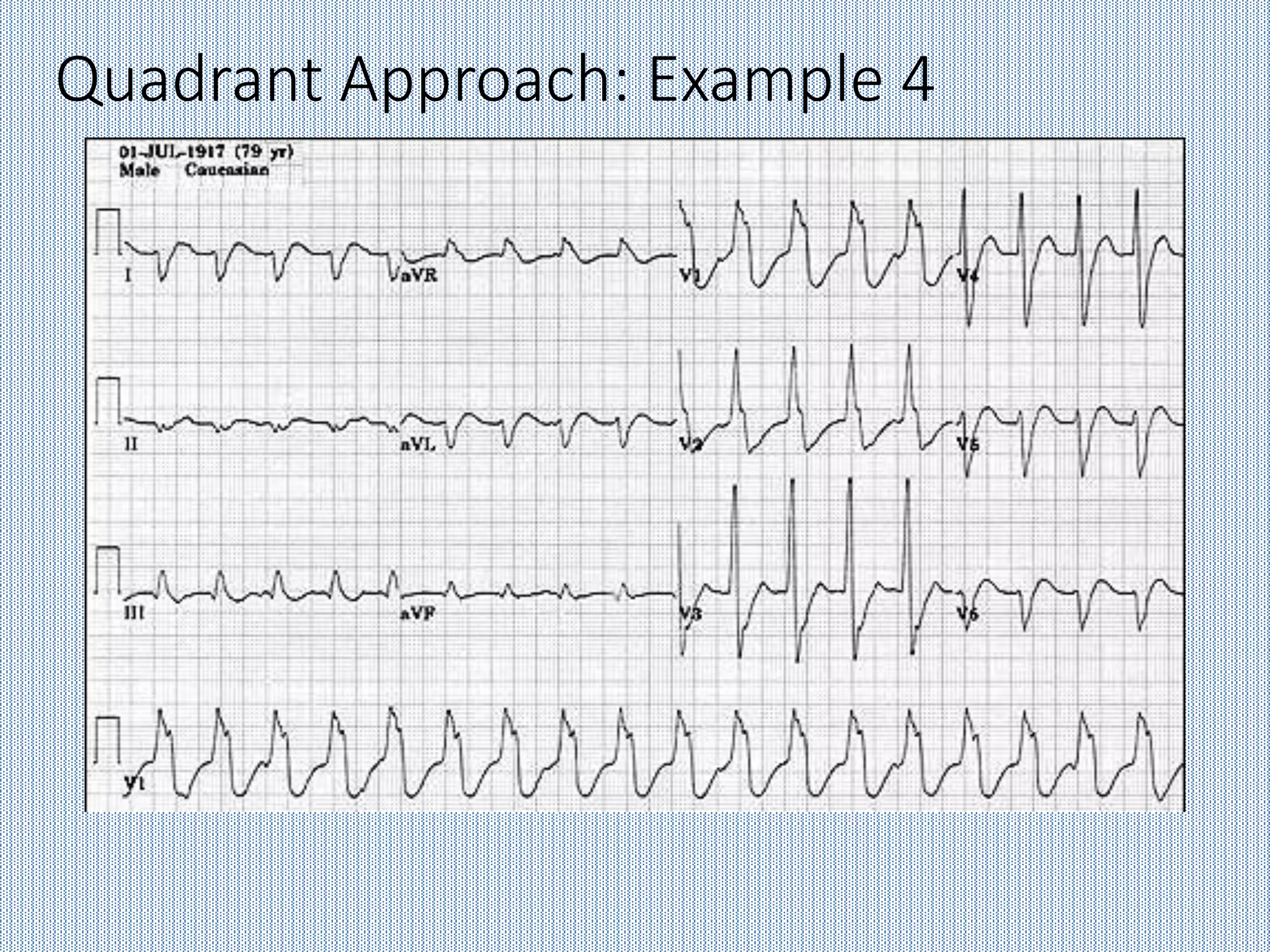 Interpretation of ECG lab session.ppt