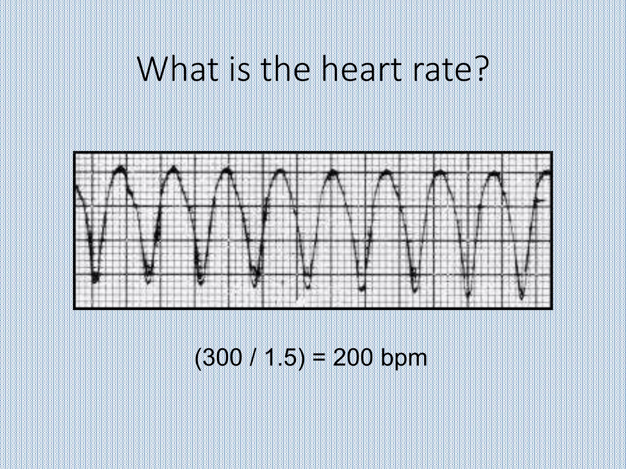Interpretation of ECG lab session.ppt