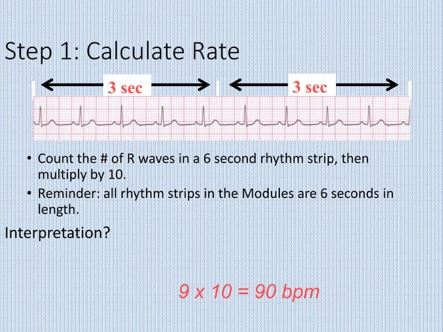 Interpretation of ECG lab session.ppt | Heart and Cardiovascular ...
