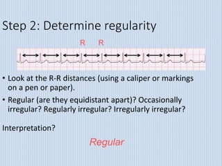 Interpretation of ECG lab session.ppt