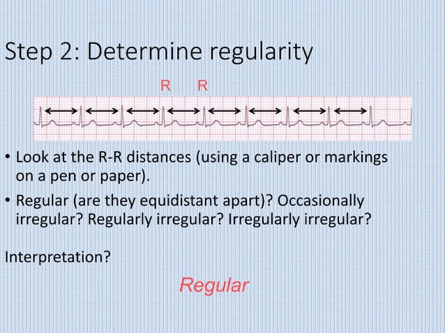 Interpretation of ECG lab session.ppt | Heart and Cardiovascular ...