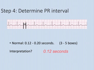 Interpretation of ECG lab session.ppt