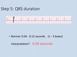 Interpretation of ECG lab session.ppt