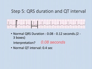 Interpretation of ECG lab session.ppt