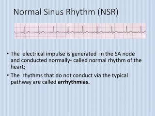 Interpretation of ECG lab session.ppt
