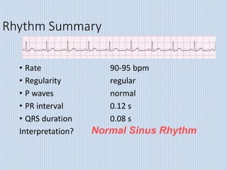 Interpretation of ECG lab session.ppt