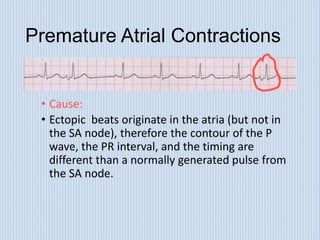 Interpretation of ECG lab session.ppt
