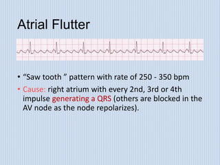 Interpretation of ECG lab session.ppt