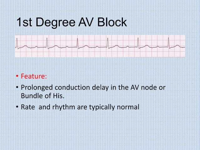 Interpretation of ECG lab session.ppt | Heart and Cardiovascular ...