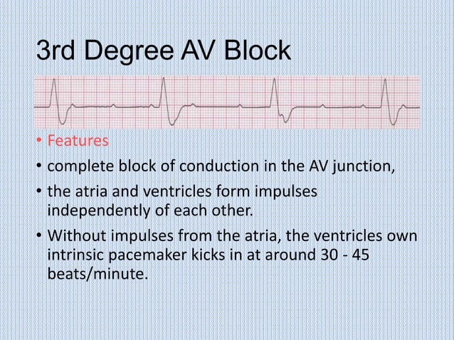 Interpretation of ECG lab session.ppt | Heart and Cardiovascular ...