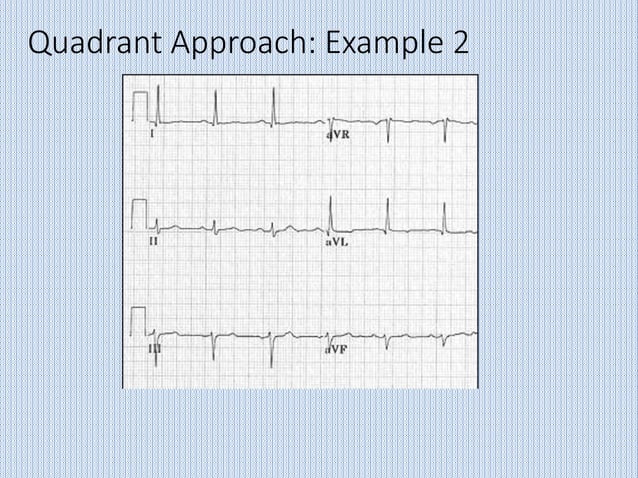 Interpretation of ECG lab session.ppt | Heart and Cardiovascular ...