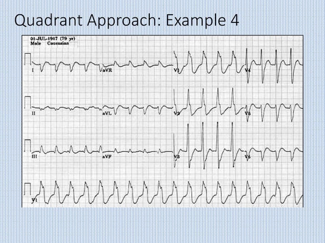 Interpretation of ECG lab session.ppt | Heart and Cardiovascular ...