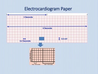 Interpretation of ECG lab session.ppt