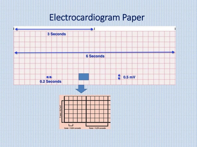 Interpretation of ECG lab session.ppt | Heart and Cardiovascular ...
