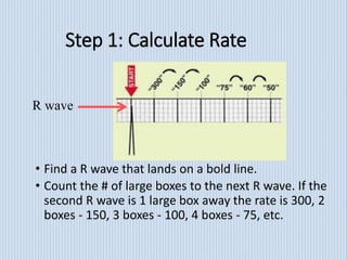 Interpretation of ECG lab session.ppt