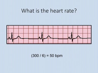 Interpretation of ECG lab session.ppt