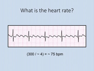 Interpretation of ECG lab session.ppt