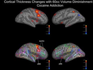 Cheif Presentation - Jerrold Frank Rosenbaum | PPT