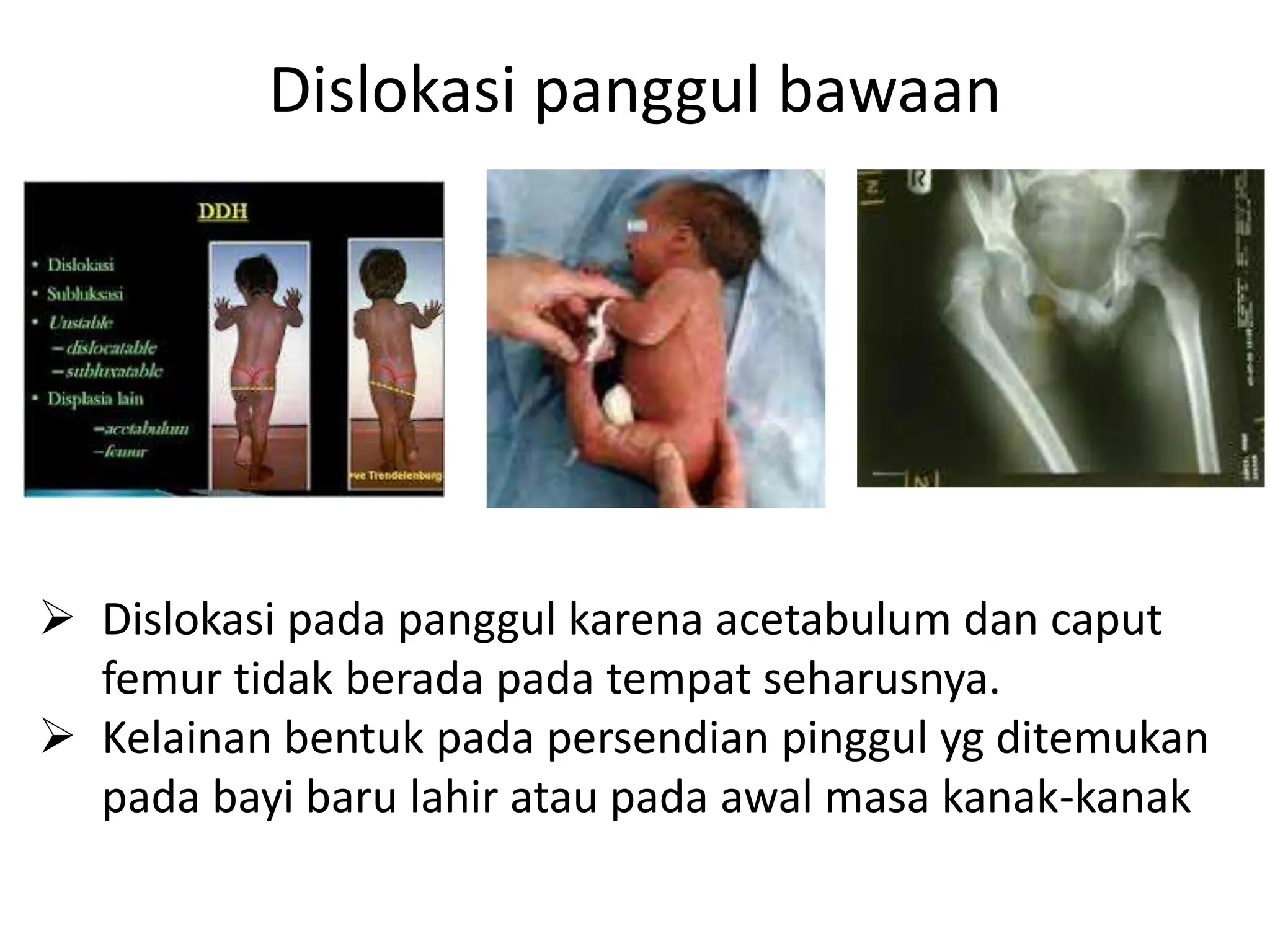 16KELAINAN_KONGENITAL_pptx.ppt