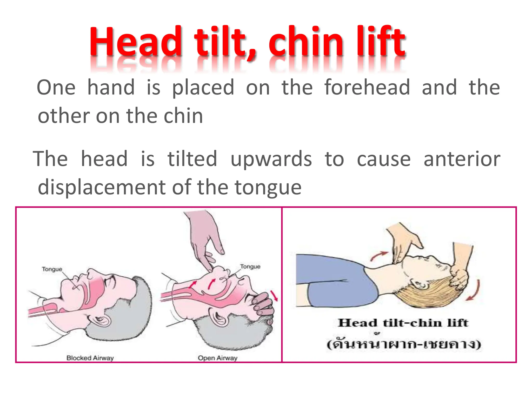 16 Pediatric CPR in hospital arrest (1).ppt