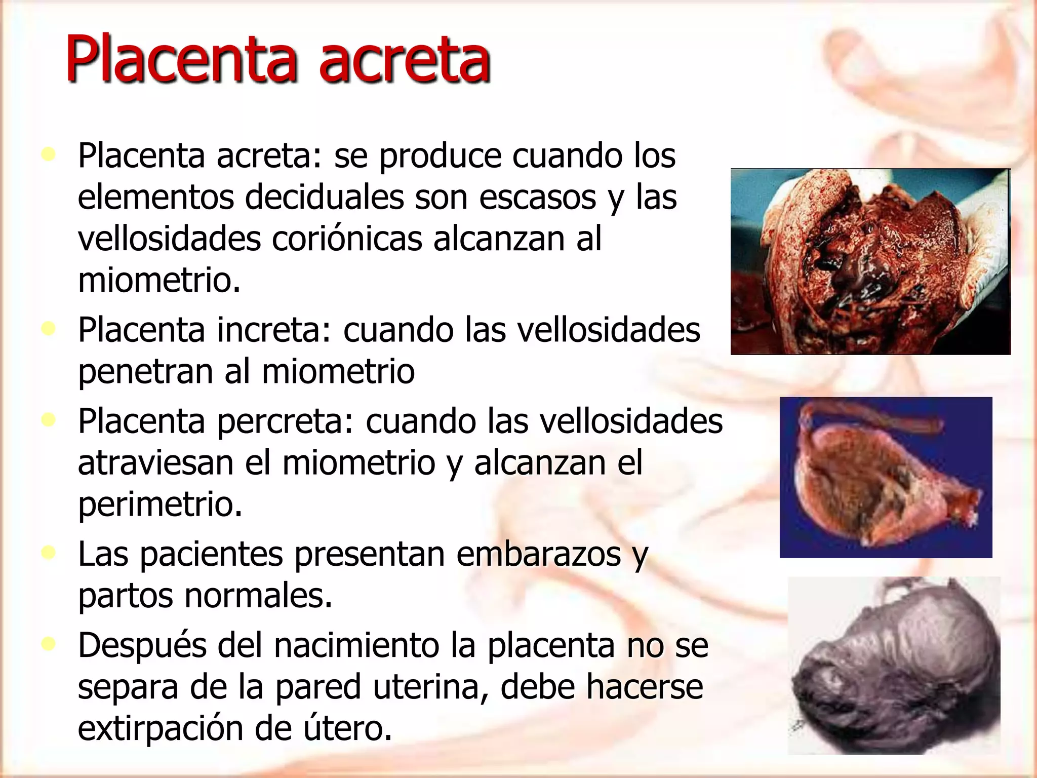 PLACENTA | PPT