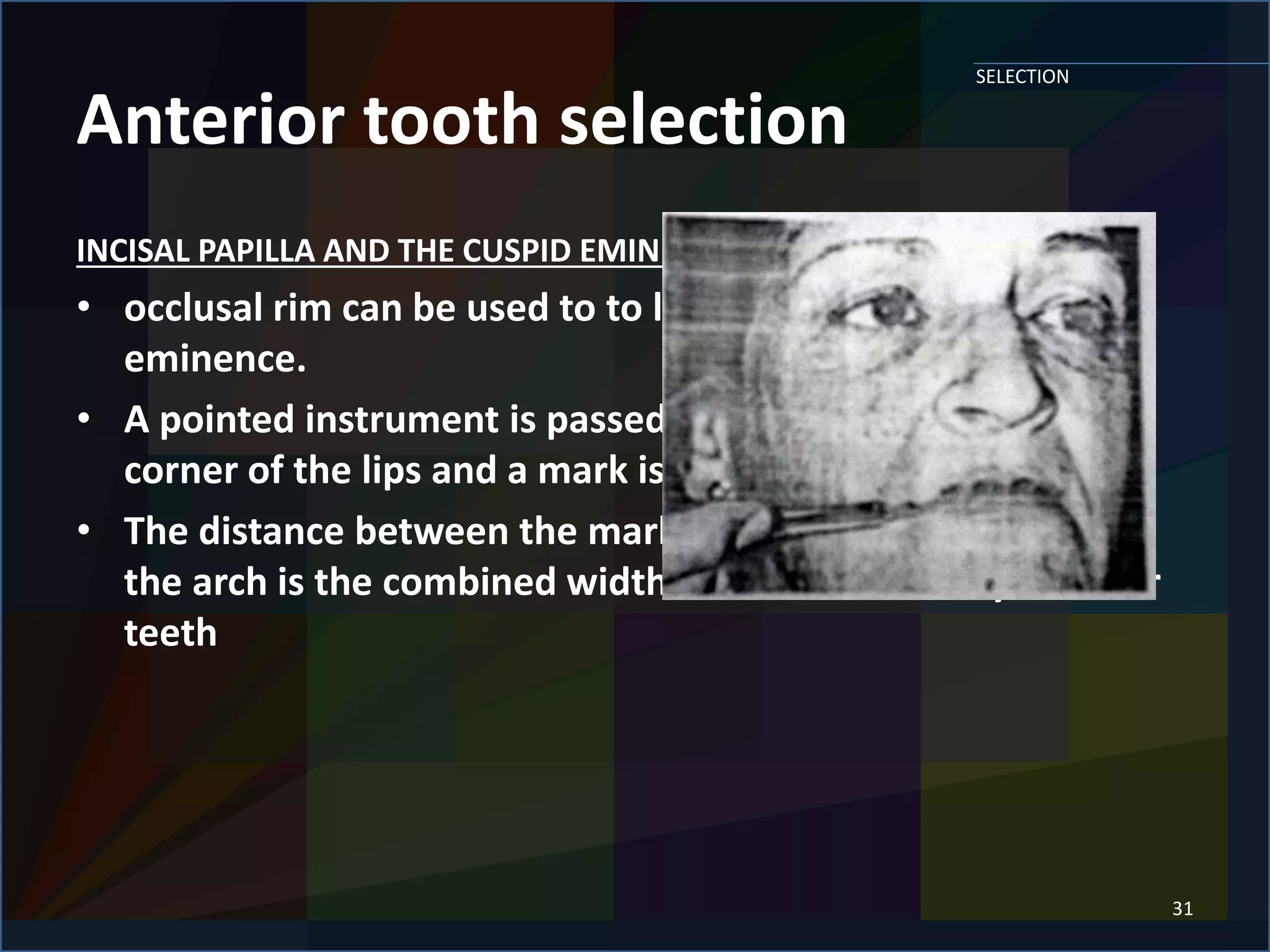 SELECTION AND ARRANGEMENT OF ARTIFICIAL TEETH | PPTX