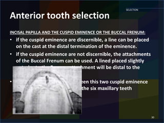 SELECTION AND ARRANGEMENT OF ARTIFICIAL TEETH | PPTX