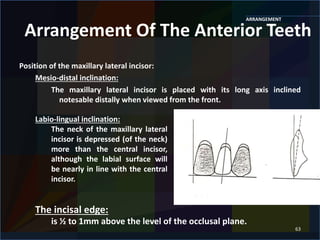SELECTION AND ARRANGEMENT OF ARTIFICIAL TEETH | PPTX