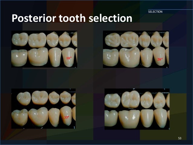 SELECTION AND ARRANGEMENT OF ARTIFICIAL TEETH