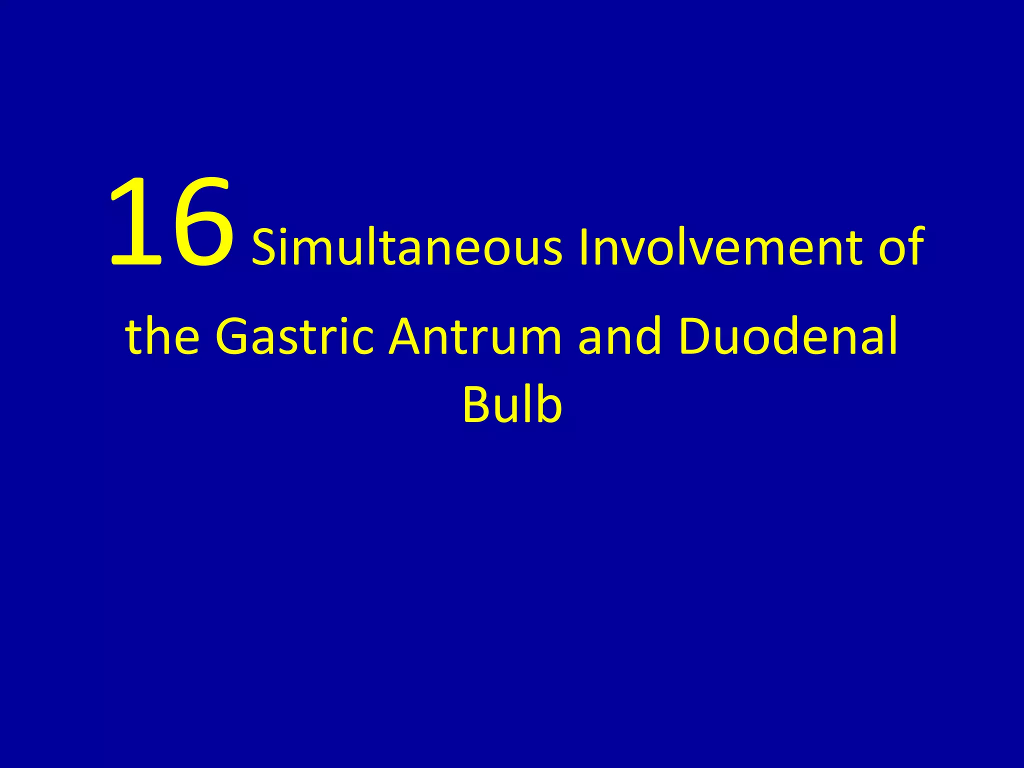 16 Simultaneous Involvement Of The Gastric Antrum And Ppt