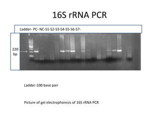 16S PCR.pptx