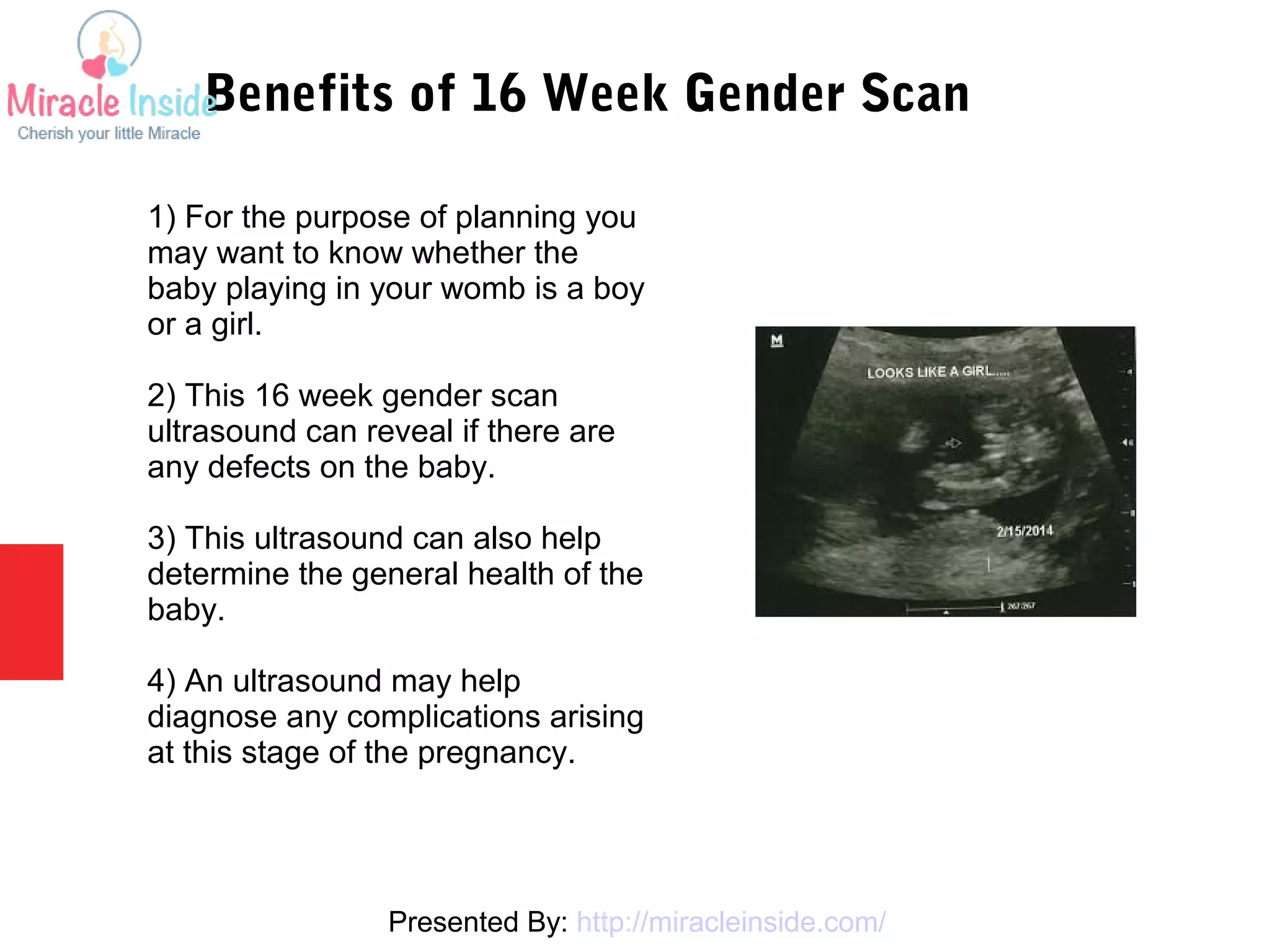 16 week gender scan | PPT