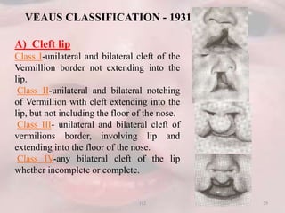 role of orthodontist in Cleft lip and palate management | PPTX