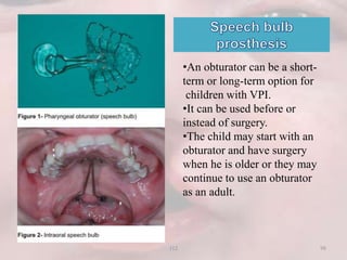 role of orthodontist in Cleft lip and palate management | PPTX