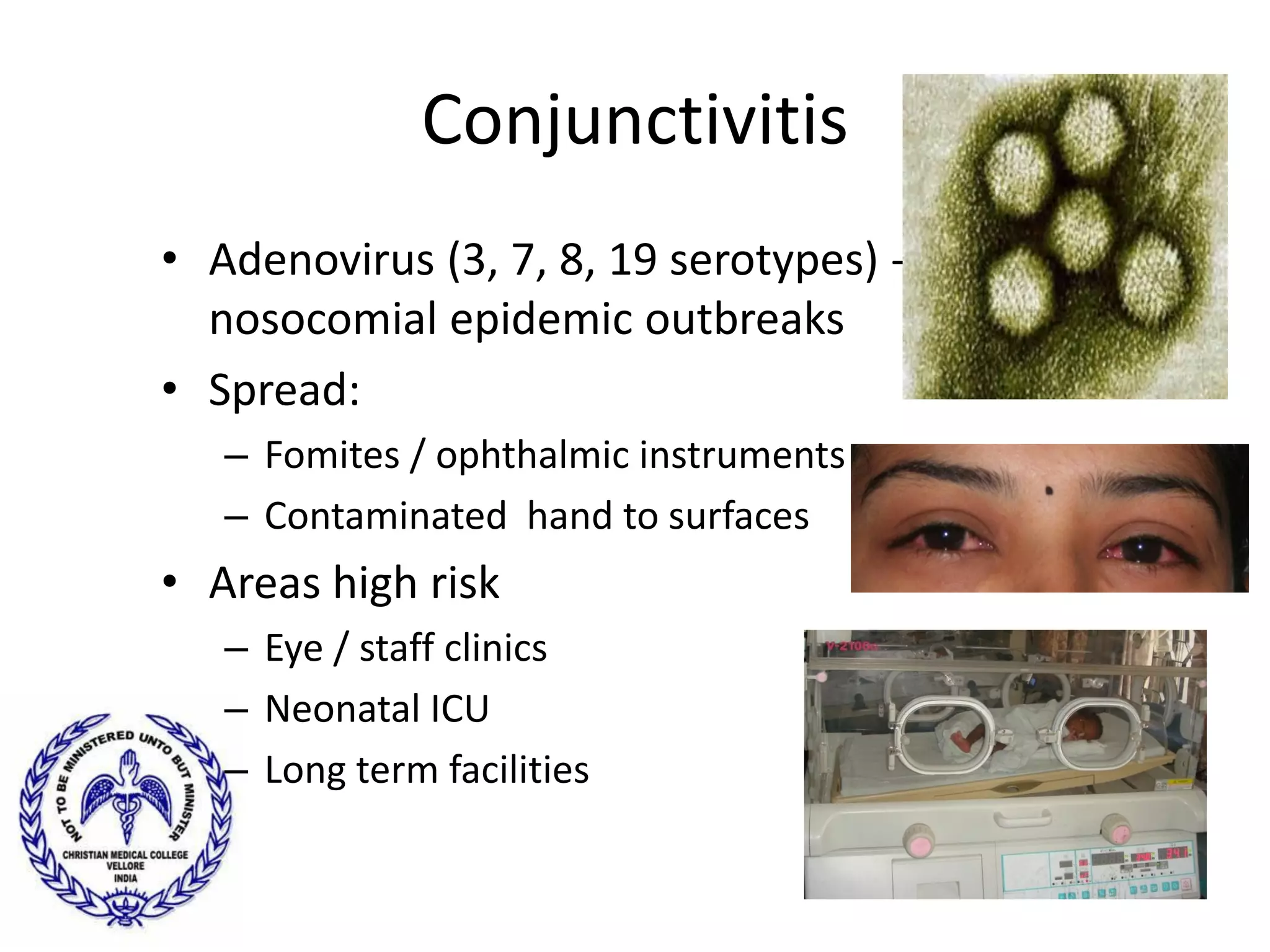 Occupational eye injuries and management | PDF