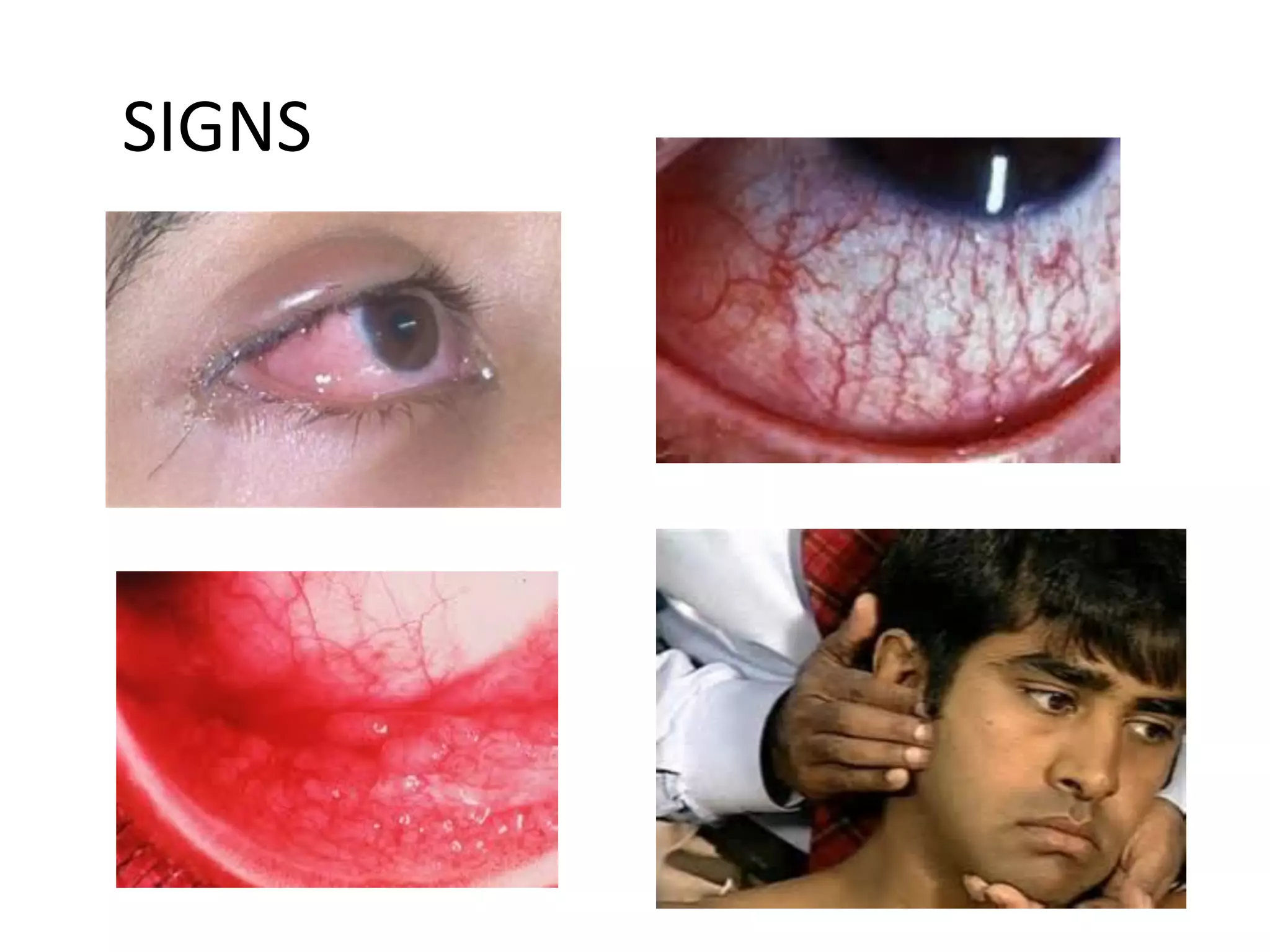 Occupational eye injuries and management | PDF