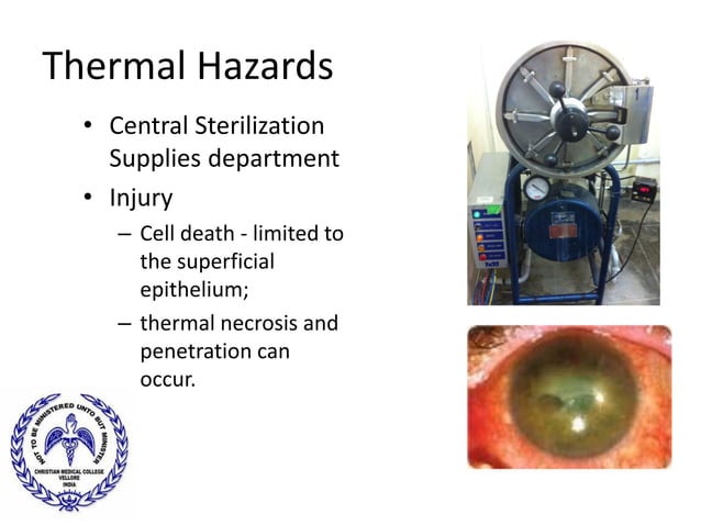 Occupational eye injuries and management | PDF | Eye and Vision ...