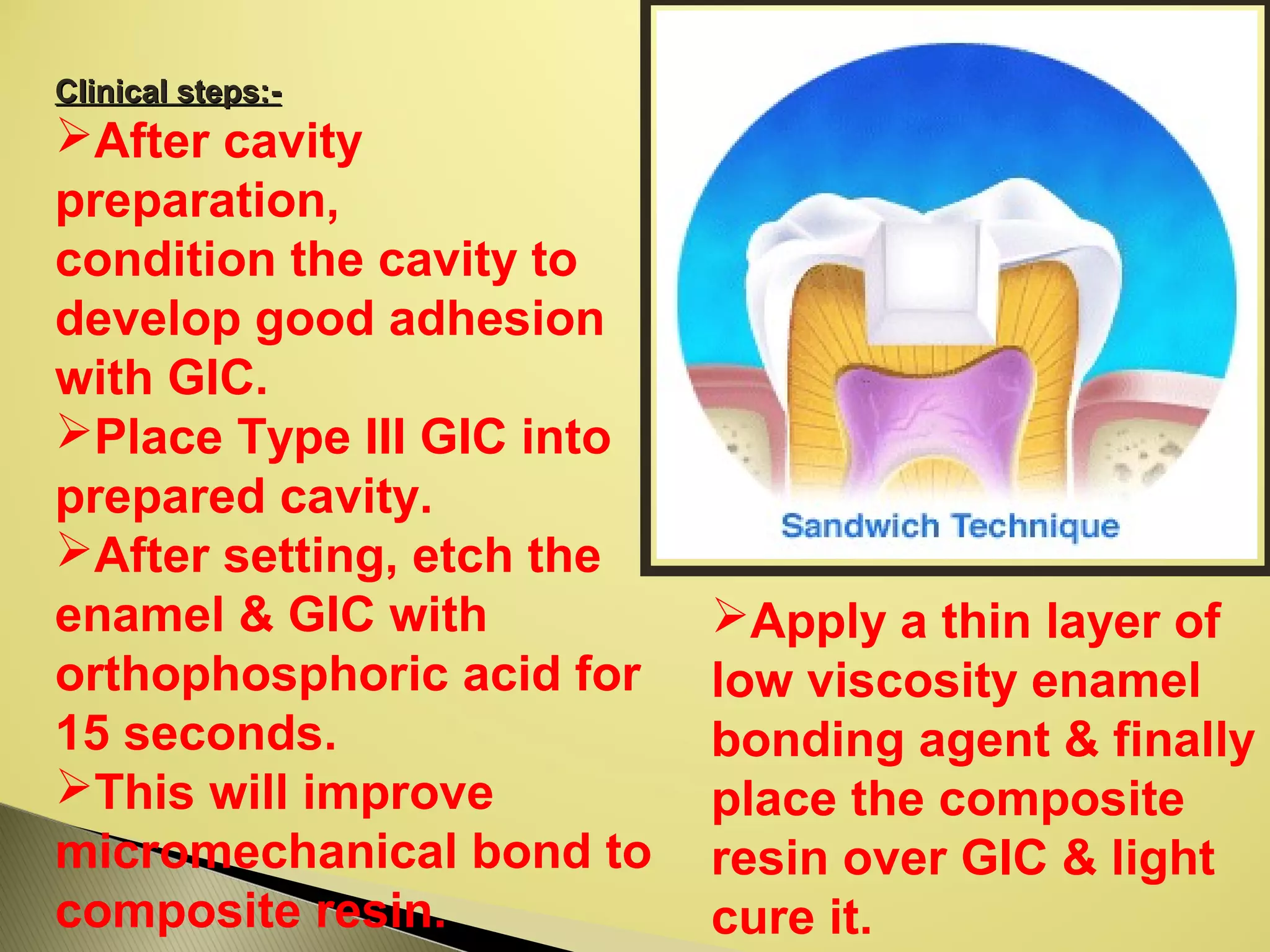 Glass Ionomer Cement | PPT