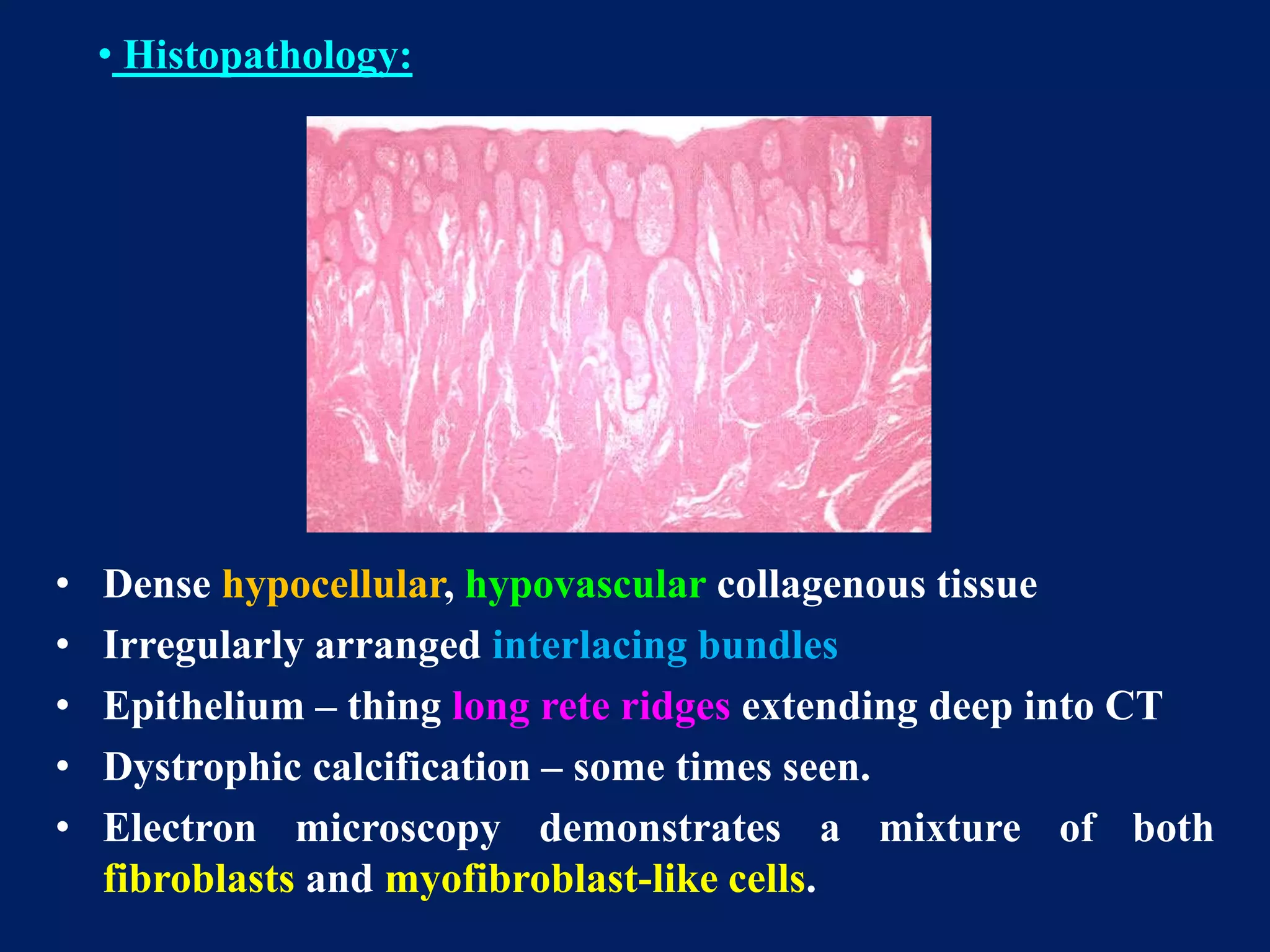 Spindle cell lesions of oral cavity part I | PPTX