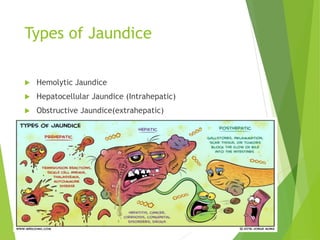 17. jaundice by arlena, given, and hilda | PPTX