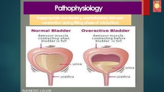 All you need to know about Overactive Bladder Disease | PPT
