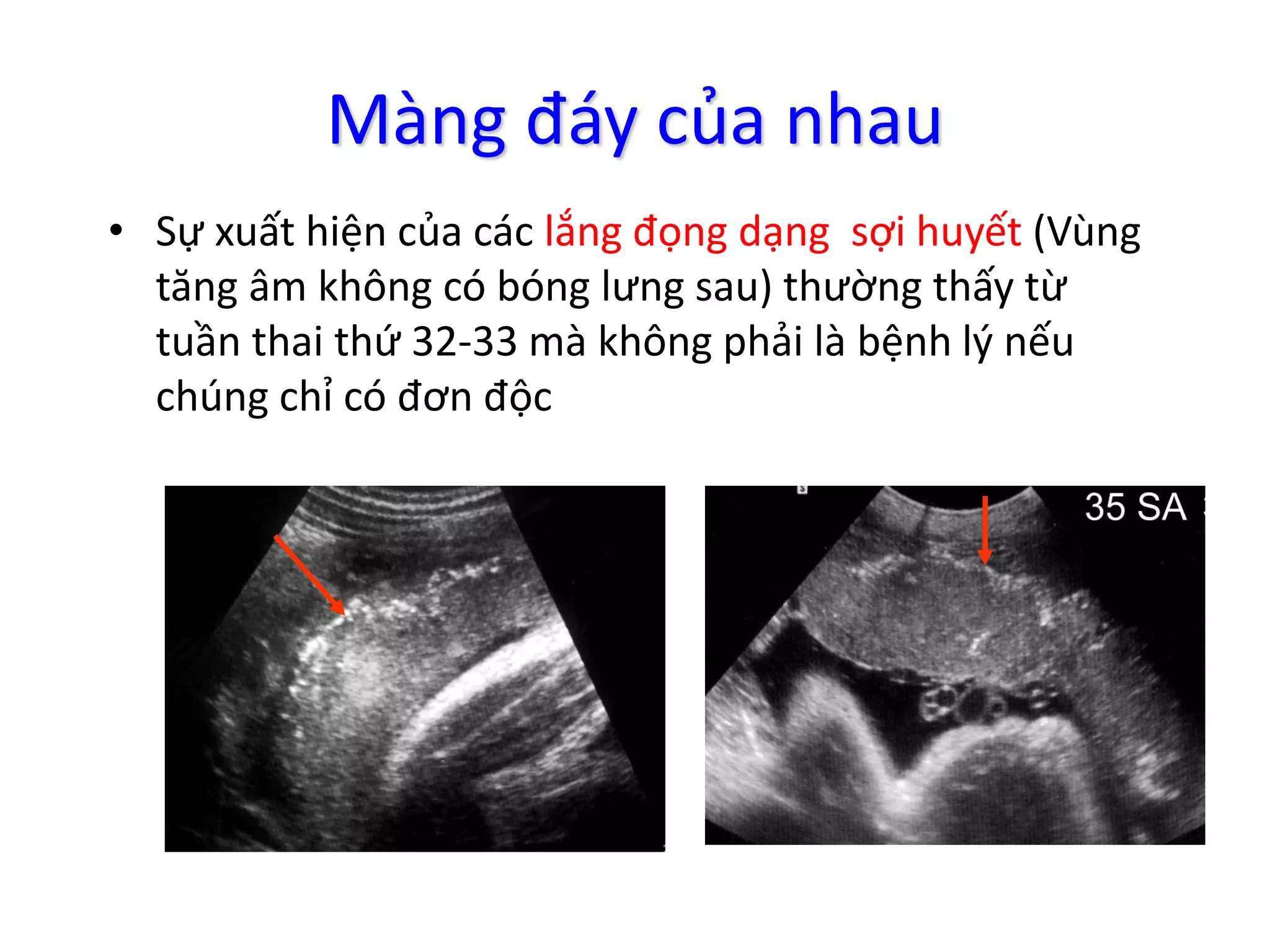 17. Sieu am banh nhau, GS Michel Collet | PDF