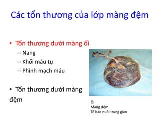 17. Sieu am banh nhau, GS Michel Collet | PDF