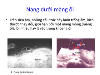 17. Sieu am banh nhau, GS Michel Collet | PDF