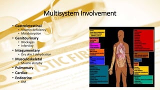 17. disorders of respiratory system | PPT
