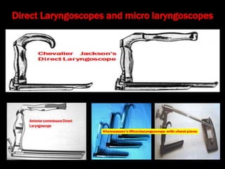 17. laryngoscopy, bronchoscopy, esophagoscopy | PPT