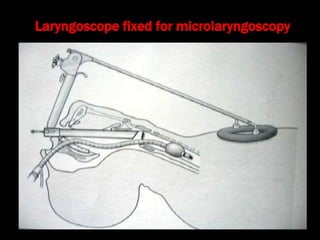 17. laryngoscopy, bronchoscopy, esophagoscopy | PPT | Death, Injury, or ...
